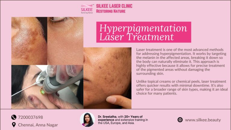 Hyperpigmentation Laser Treatment - Silkee Skin & Hair Clinic